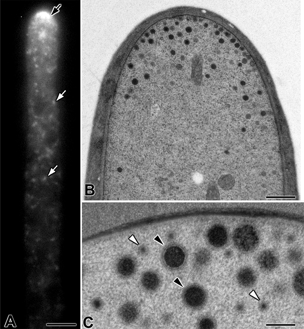 Coemansia reversa (Mucoromycota).jpg | ASU Search